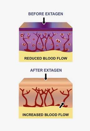 Does Extagen Really Work?